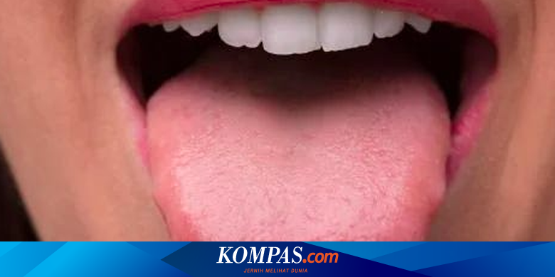 4 Jenis Penyakit Lidah yang Jarang Diketahui dan Gejalanya