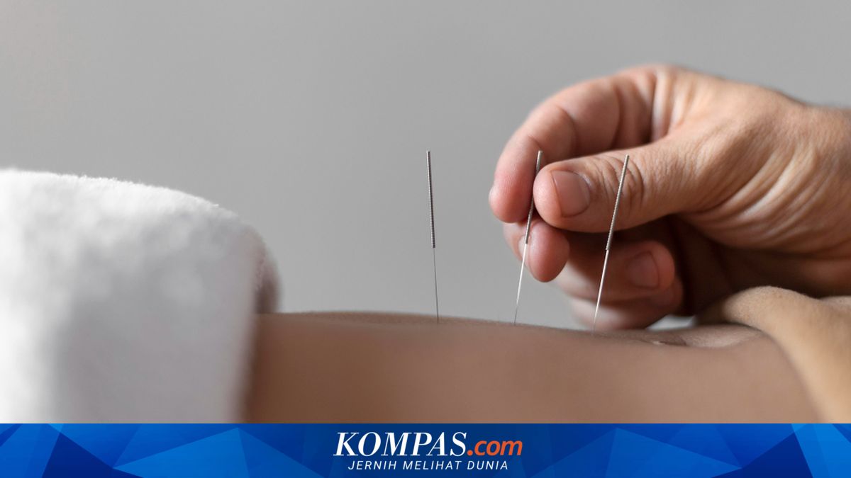Berbagai Fakta Akupunktur, Cara Kerja, Manfaat, hingga Risikonya