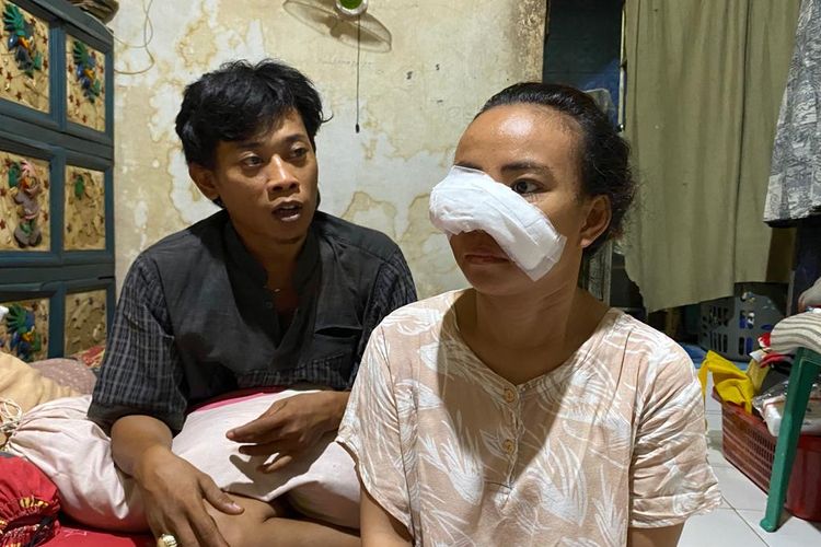 Foto : Kesal Tak Kunjung Dinikahi, Perempuan di Tambora Lukai Wajah ... Foto : Kesal Tak Kunjung Dinikahi, Perempuan di Tambora Lukai Wajah ...