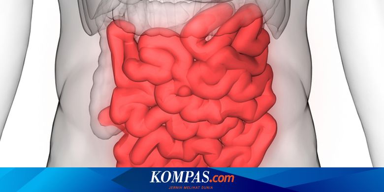 Apa Itu Perlengketan Usus, Penyebab, dan Tanda-tanda