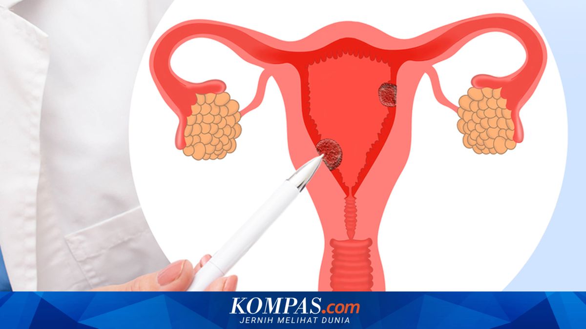 Apakah Polip Rahim Bisa Sembuh Sendiri?