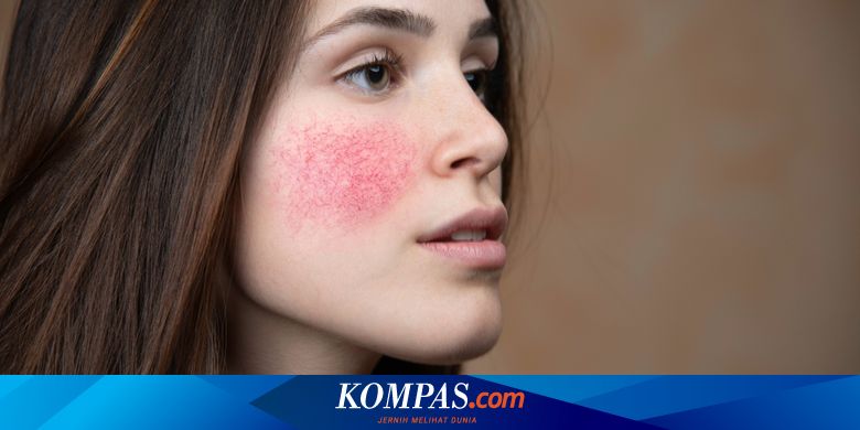 Kenali Tanda Awal Infeksi Kulit akibat Kosmetik Bermerkuri