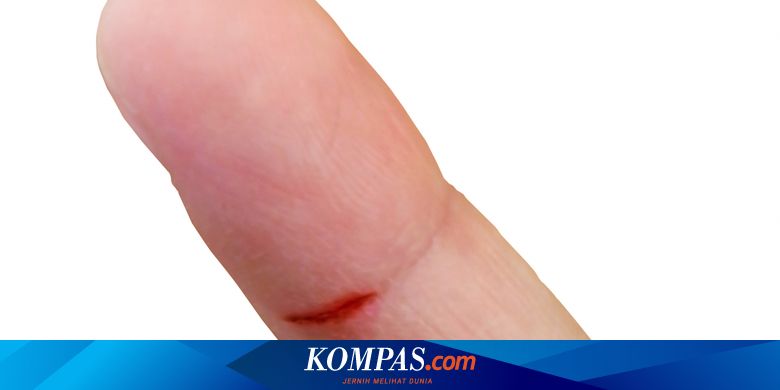 Mengapa Luka Sayatan dari Kertas Sangat Perih?