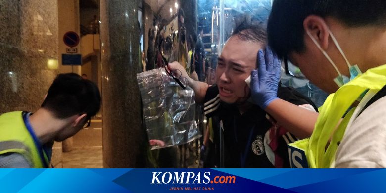 Telinga Politisi Hong Kong Ini Putus Digigit karena "Perbedaan Politik"