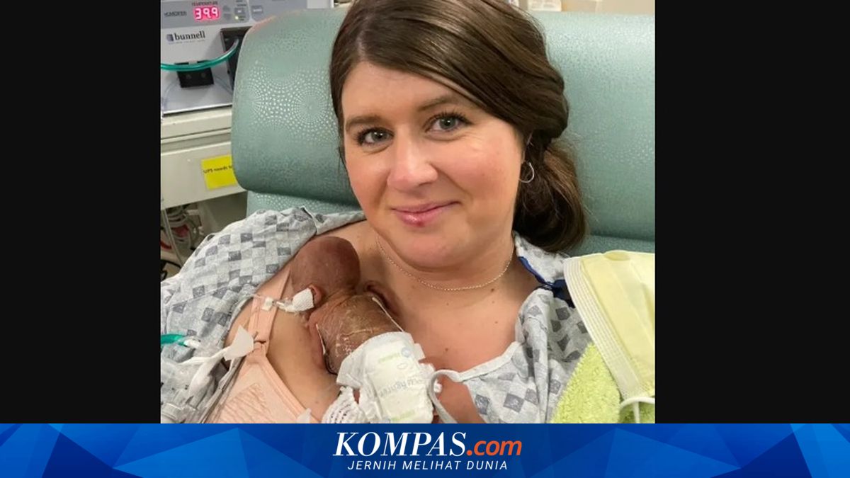Si Mungil dari Iowa yang Lahir pada Usia 21 Minggu Jadi Bayi Paling ...