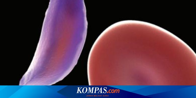 Kadar Trombosit Rendah: Penyebab, Gejala, dan Cara Mengatasinya