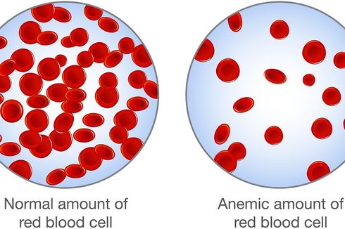 Berita Harian Jenis-jenis-anemia Terbaru Hari Ini - Kompas.com