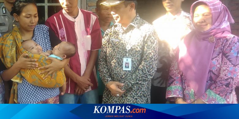 Kisah Meysa dan Meyka, Bayi Kembar Siam Dempet Perut asal Gunungkidul