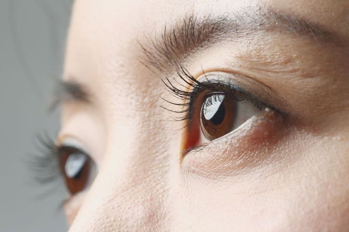 Dewi Yull Alami Ablasio Retina, Ini Langkah yang Bisa Dilakukan