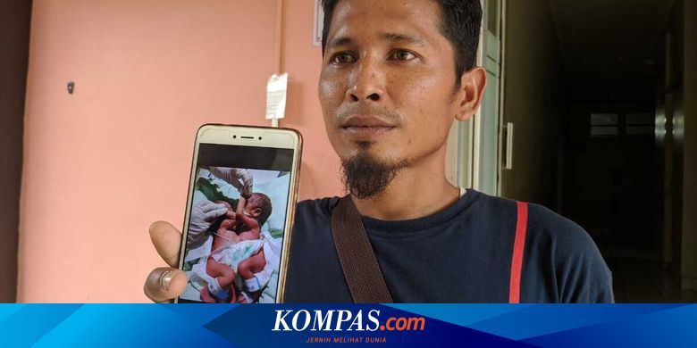 Bayi Kembar Siam Dempet Perut dan Dada Lahir di Medan