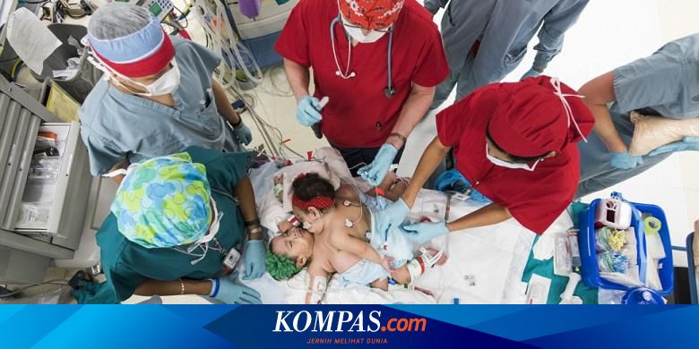 Dempet Dada dan Perut, Bayi Kembar Ini Berhasil Dipisahkan