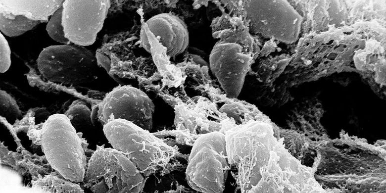 Contoh Organisme Kingdom Monera