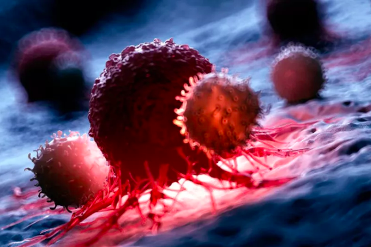 Apa Penyebab Utama Kanker? Simak Penjelasannya