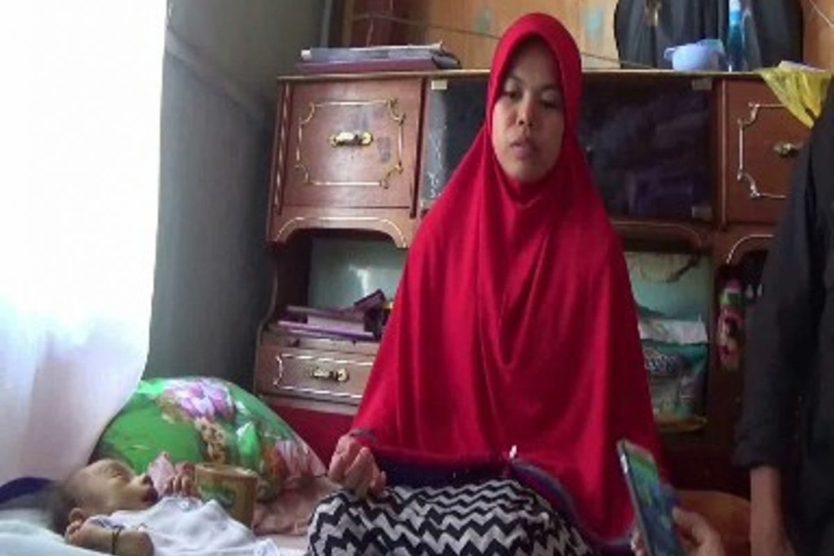 Derita Gizi Buruk dan Terinfeksi Rubella, Bayi 8 Bulan Tinggal Tulang ...
