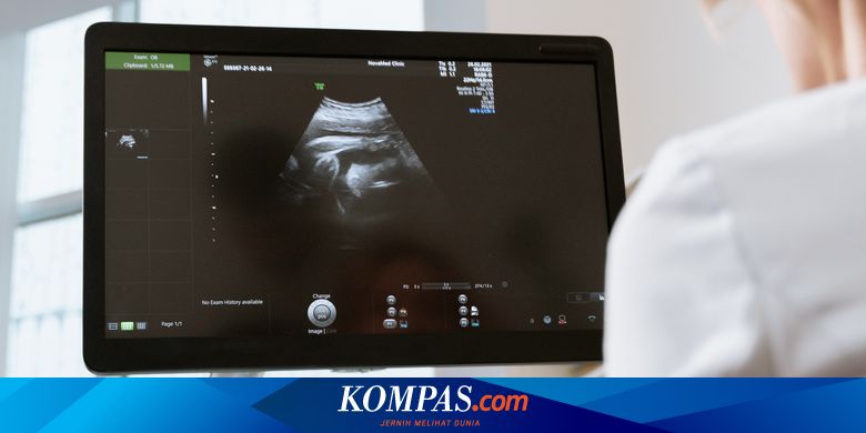 Ini Perbedaan USG 2D, 3D, dan 4D