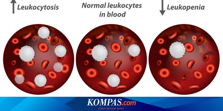 Leukositosis dan Leukimia, Kondisi Jumlah Leukosit di Atas Normal