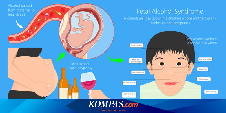 Penyakit Fetal Alcohol Syndrome (FAS) atau Sindrom Alkohol Janin ...
