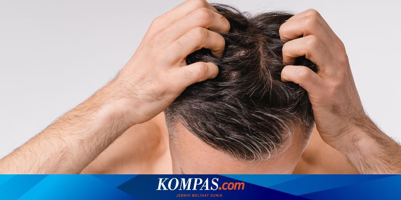 Penyakit Dermatitis Seboroik - Gejala, Penyebab, Pengobatan - Kompas.com
