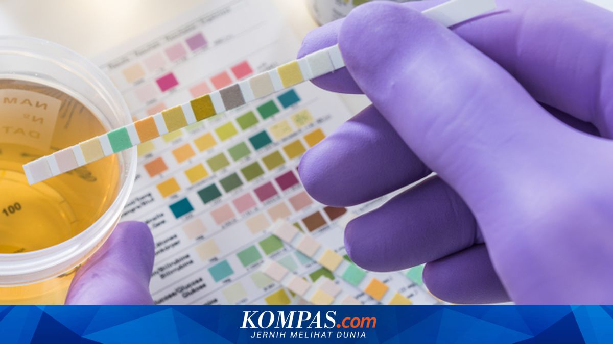 Mengenal Apa Itu Urine dan Kandungannya