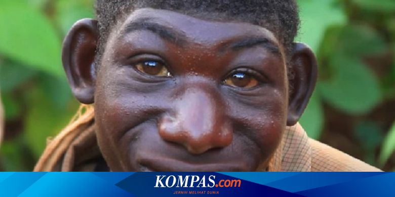 Fakta Zanziman Ellie, Pemuda yang Dijuluki "Mowgli Dunia Nyata"