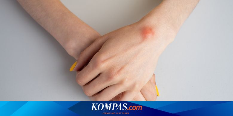 Apa Penyebab Penyakit Kista pada Wanita? Berikut 10 Daftarnya…