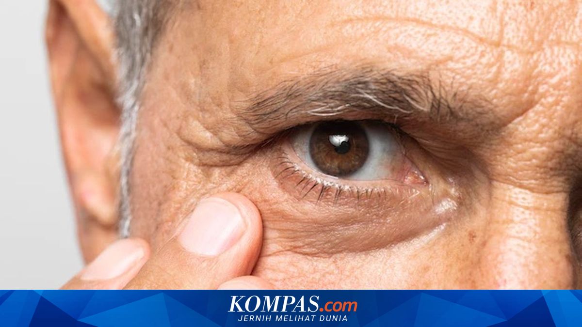 7 Gejala Diabetes yang Muncul di Mata, Mulai dari Mata Merah dan ...