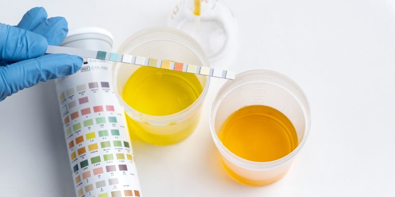 Bagaimana Proses Pembentukan Urine? - Kompas.com