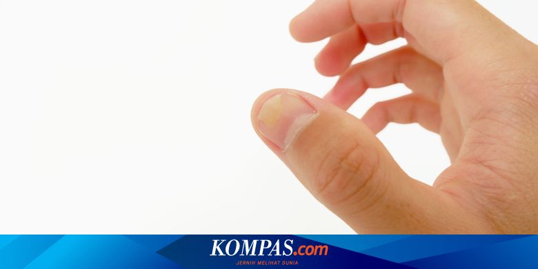 5 Penyebab Kuku Kuning, Bisa Karena Kuteks sampai Penyakit
