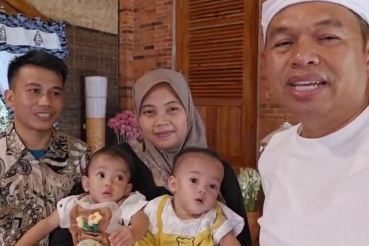 Bayi Kembar Siam Asal Tasikmalaya Akan Dioperasi, Dedi Mulyadi Tegaskan Operasi Tanpa Biaya