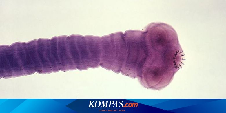 Kasus Langka, Dokter Temukan Cacing Pita dan Ribuan Telur di Mata Pria