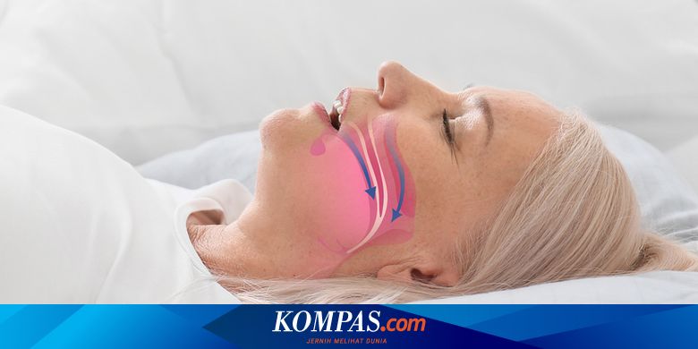 Mengenal Apa Itu Obstructive Sleep Apnea, Penyebab, dan Gejalanya