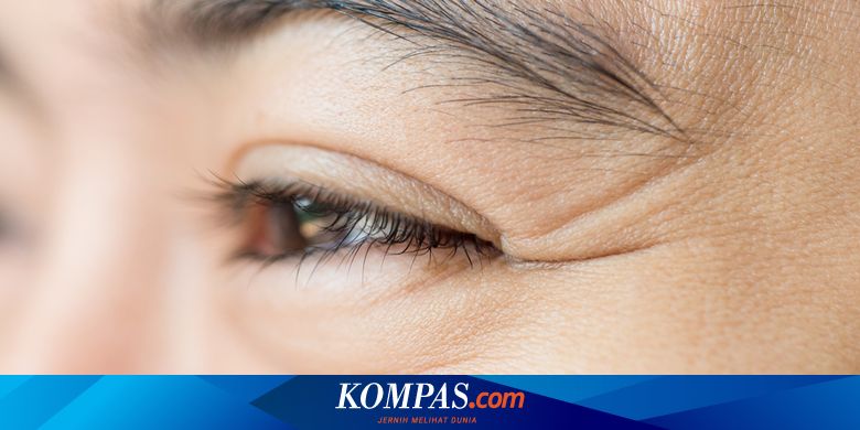 4 Penyebab Mata Keriput dan Cara Menghilangkannya