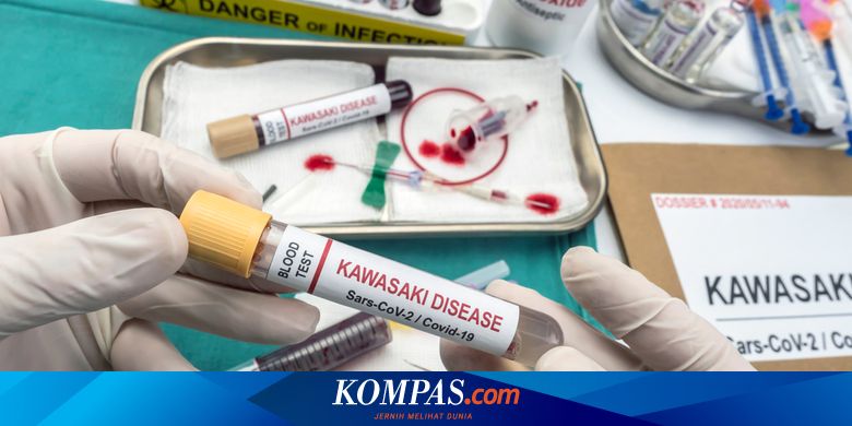 5 Gejala dan Penyebab Penyakit Kawasaki yang Berbahaya pada Anak