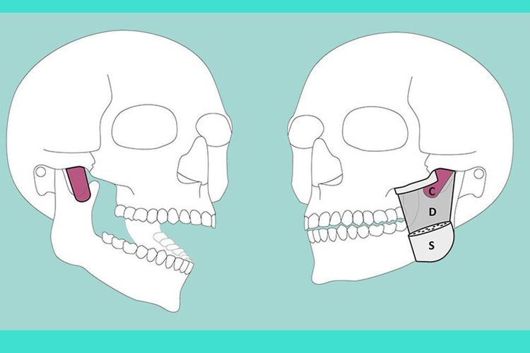 Peneliti Temukan Bagian Baru Tubuh Manusia, Seperti Apa Bentuknya?