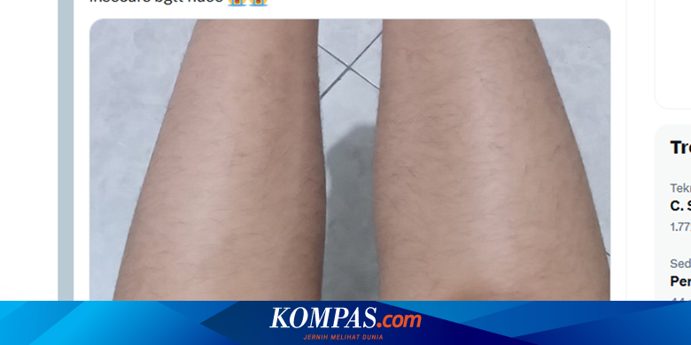 Ramai soal Kulit Lutut Menghitam, Bagaimana Cara Mengatasinya?