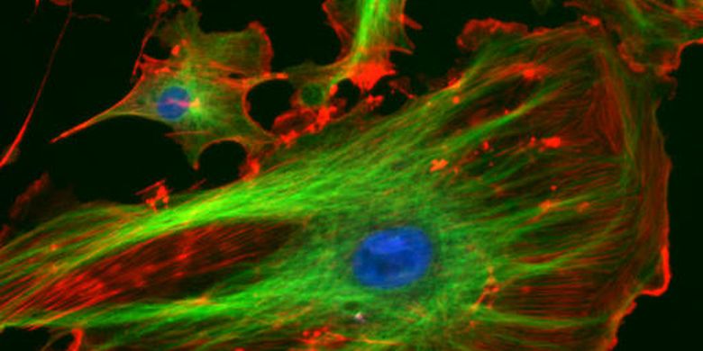 Sitoskeleton: Fungsi dan Komponen Penyusunnya