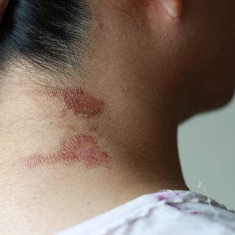 5 Hal yang Menandakan Kualitas Udara di Rumah Kamu Buruk