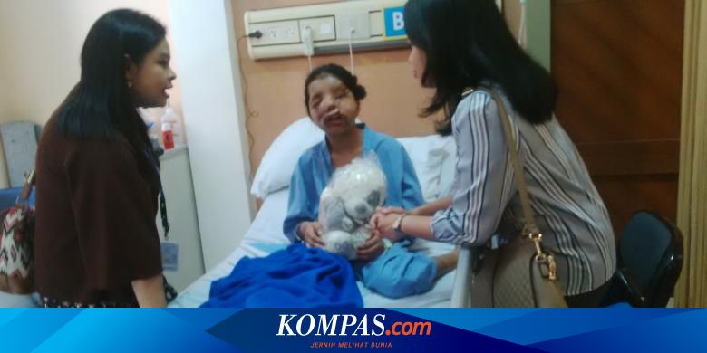 Perbedaan Operasi pada Gadis Sumbing Wajah dengan Lisa "Face Off"