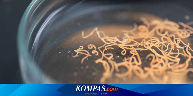 Kata Dokter soal Kasus Raya, Bocah 3 Tahun yang Meninggal dengan Tubuh Penuh Cacing