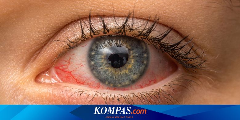 Kenapa Mata Tiba-tiba Merah? Kenali 8 Penyebab dan Cara Mengatasinya