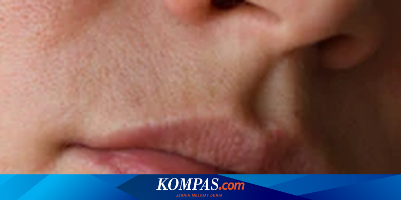 Berita Harian Philtrum Lekukan Di Bawah Hidung Terbaru Hari Ini ...