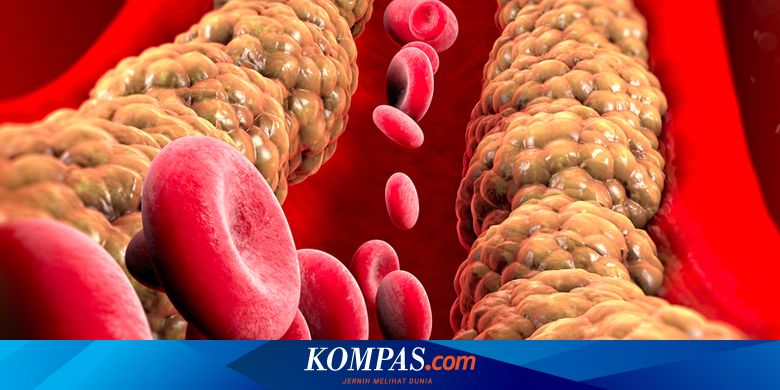 Kadar Trigliserida Tinggi Menyebabkan Apa?