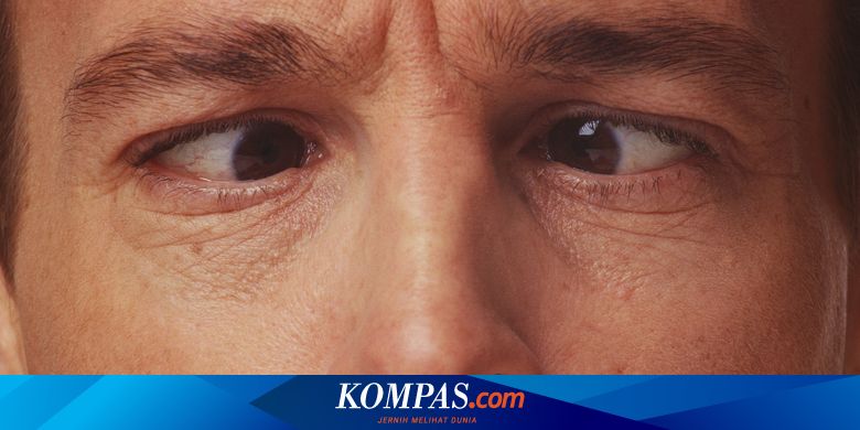 Dokter UGM: Ini Gejala Mata Juling