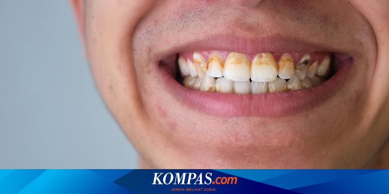 Bisakah Karang Gigi Rontok dengan Pasta Gigi? Ini Penjelasan Dokter