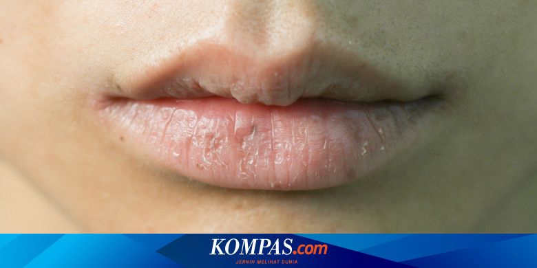 Penyakit Bibir Pucat - Gejala, Penyebab, Pengobatan - Kompas.com