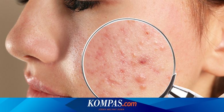 Macam Macam Penyakit Kulit Yang Perlu Diketahui