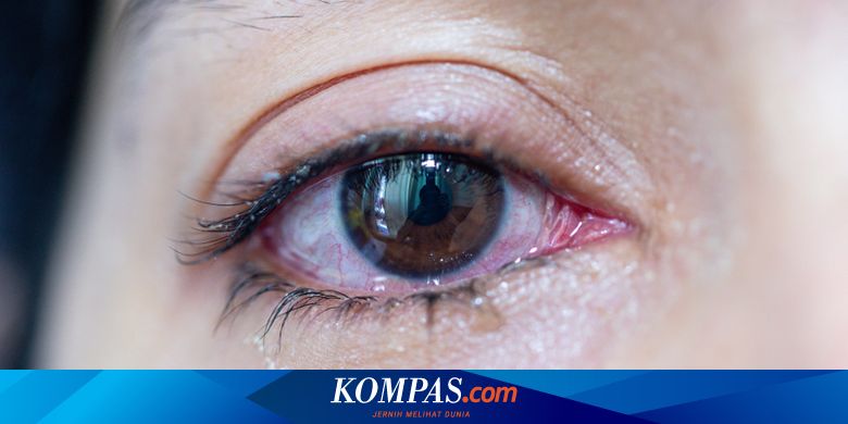 Berita Terkini Harian Kenapa Mata Berair Terbaru Hari Ini - Kompas.com