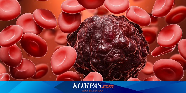 Penyakit Penyebab Trombosit Rendah Termasuk Leukemia