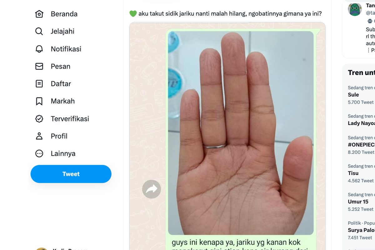 Jari Tangan Mengerut Saat Terkena Air, Apakah Sidik Jari Bisa Hilang?