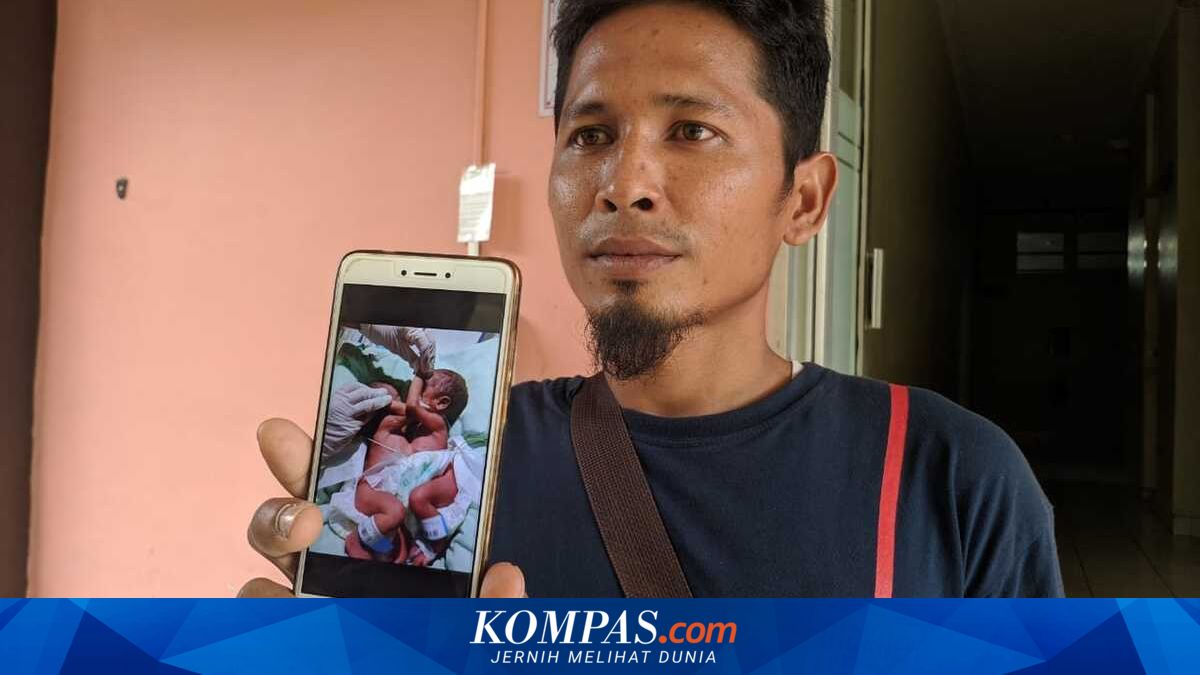 Bayi Kembar Siam Dempet Perut dan Dada Lahir di Medan